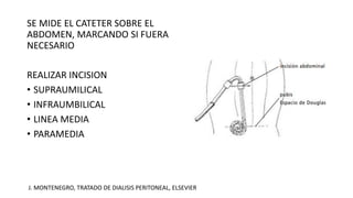 Dialisis peritoneal | PPTX