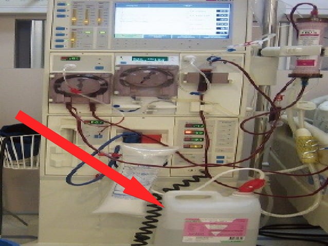 Dialysate Calcium Concentartions and CKD MBD Dr. Karem Salem | PPT ...