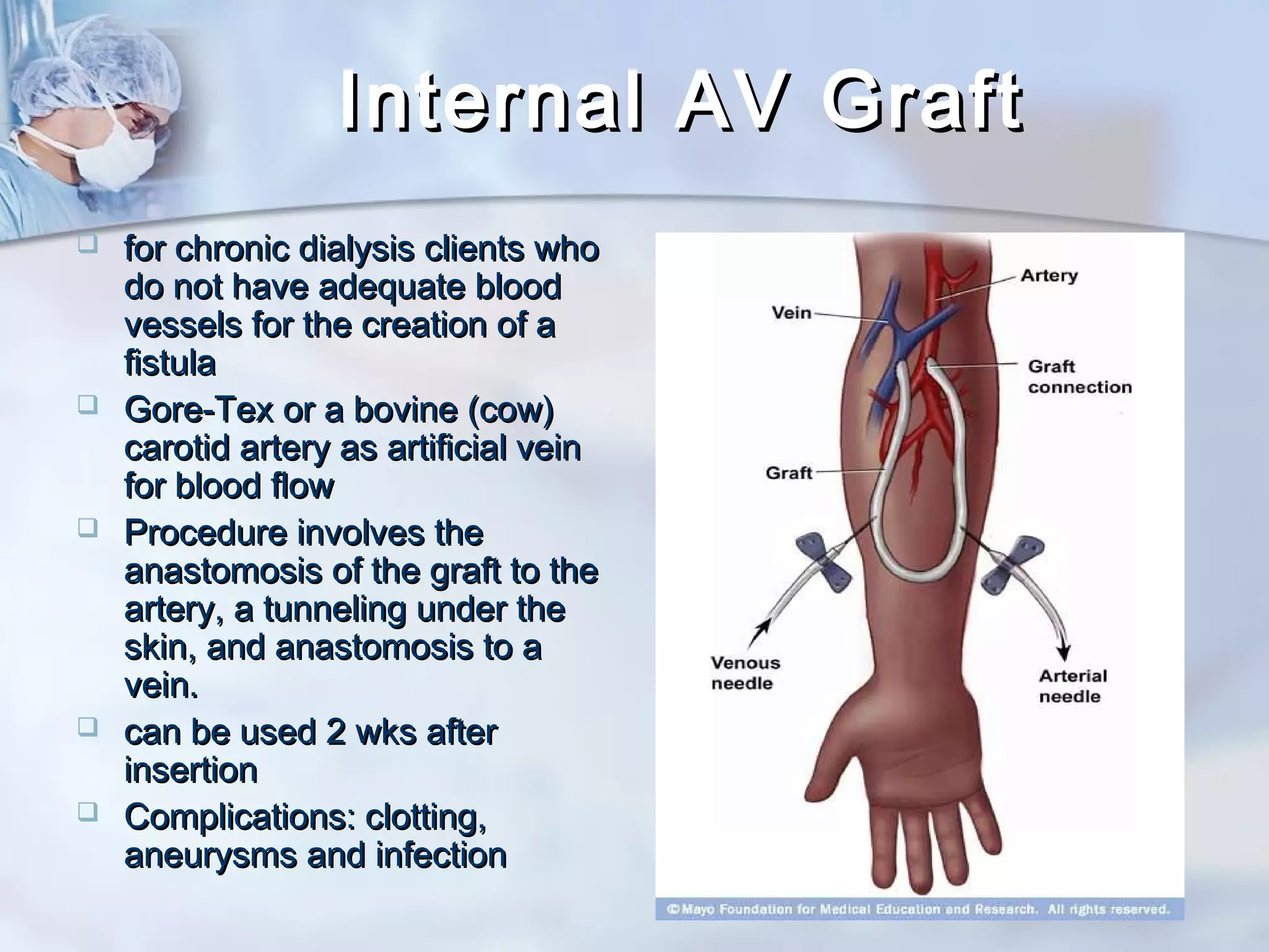 Dialysis | PPT