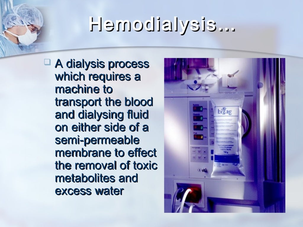 Dialysis Complete Information About Dialysis And Its
