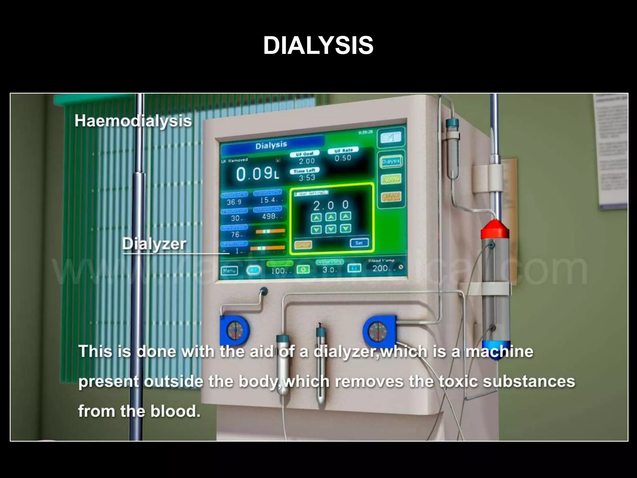 Dialysis | PPTX