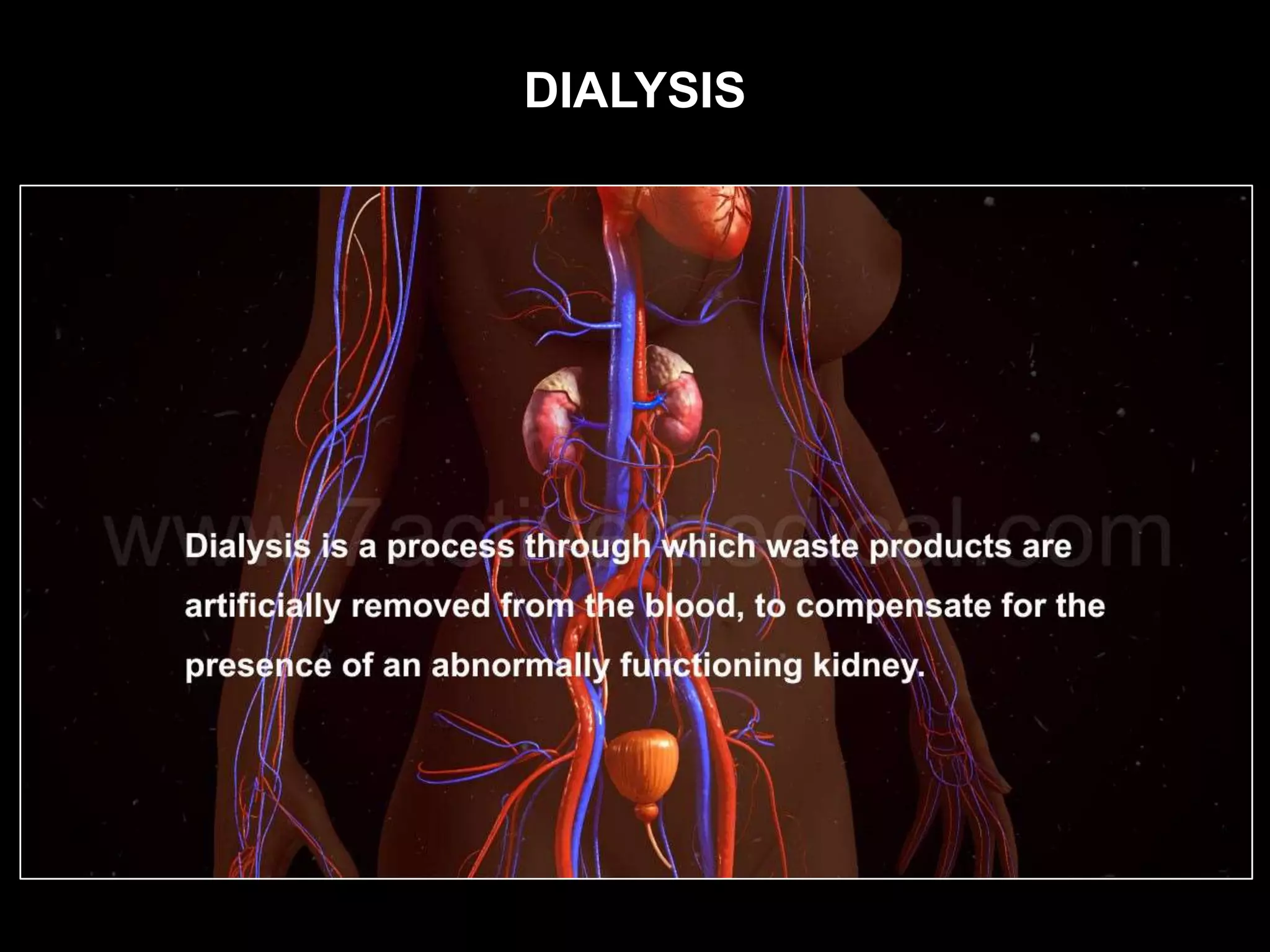Dialysis | PPTX