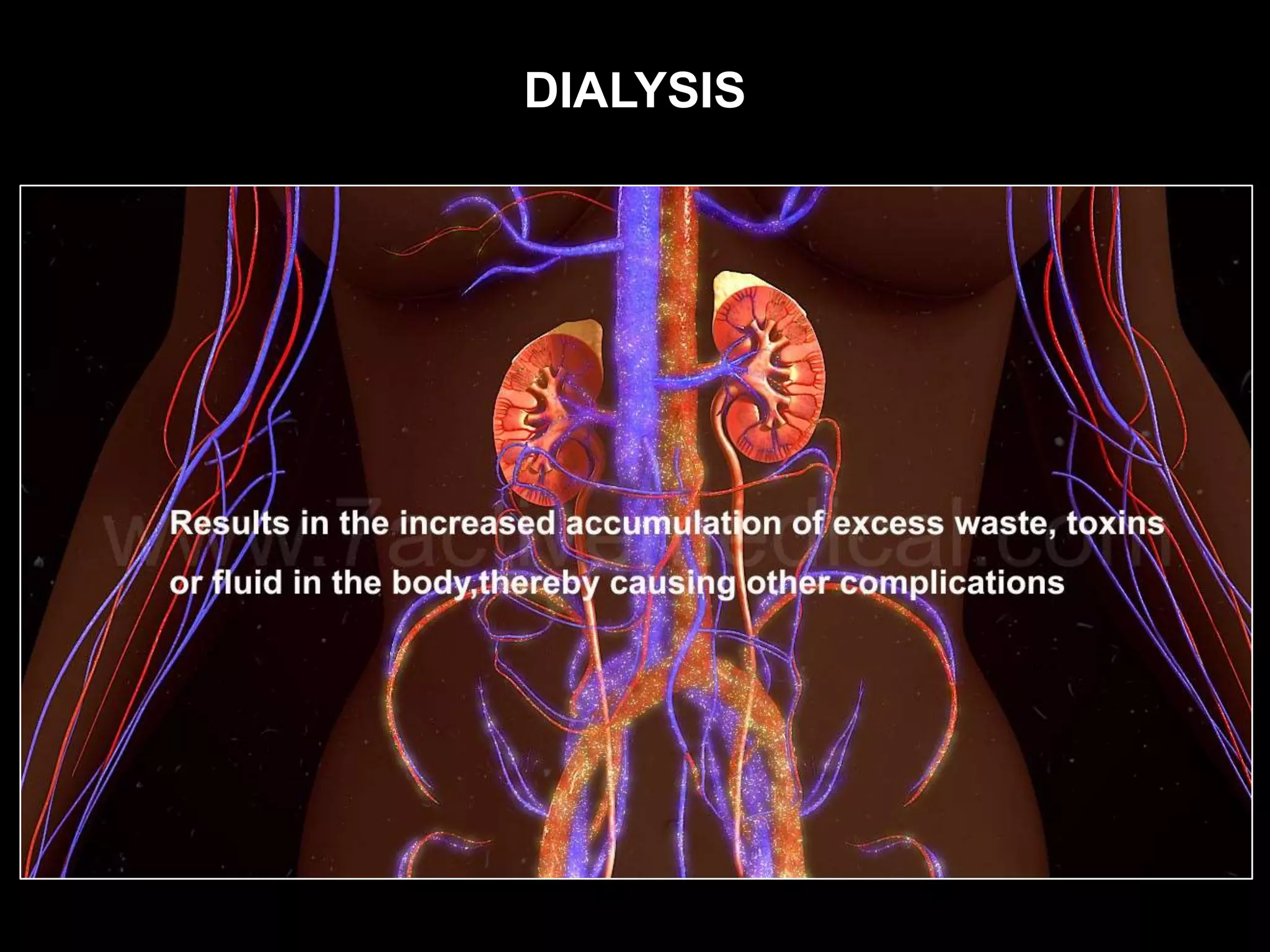 Dialysis | PPTX