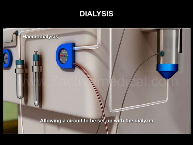 Dialysis | PPTX