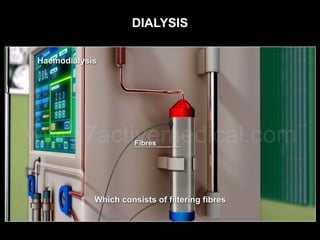 Dialysis | PPTX
