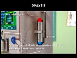 Dialysis | PPTX