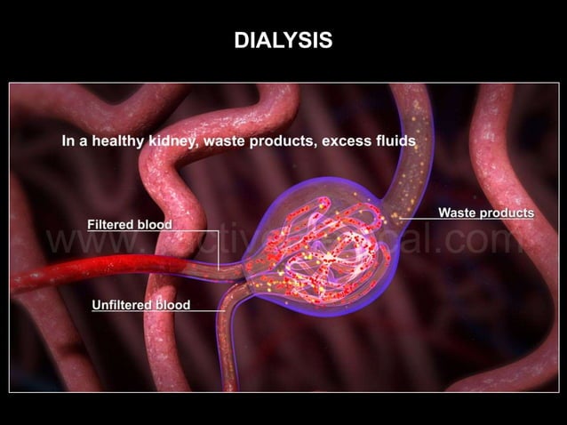 Dialysis | PPTX