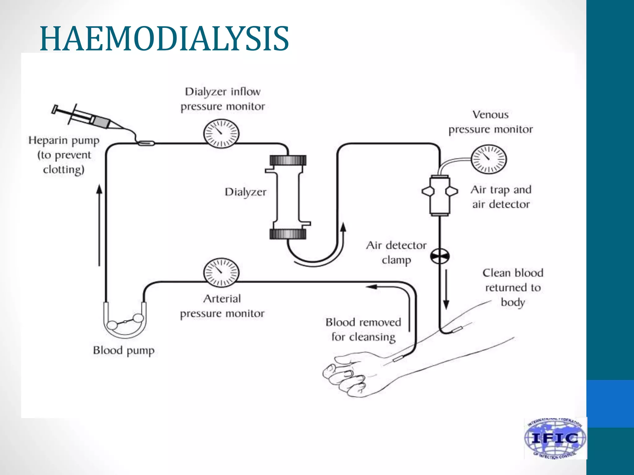 Dialysis | PPTX