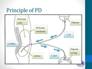 Dialysis | PPT