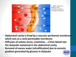 Dialysis | PPT