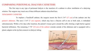Dialysis | PPT