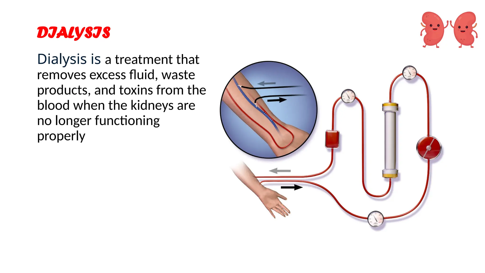 DIALYSIS- HEMODIALYSIS AND PERITONEAL DIALYSIS, INDICATIONS, PRINCIPLES ...