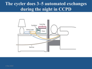 Dialysis Hemodialysis for Acuterenal failure.pptx