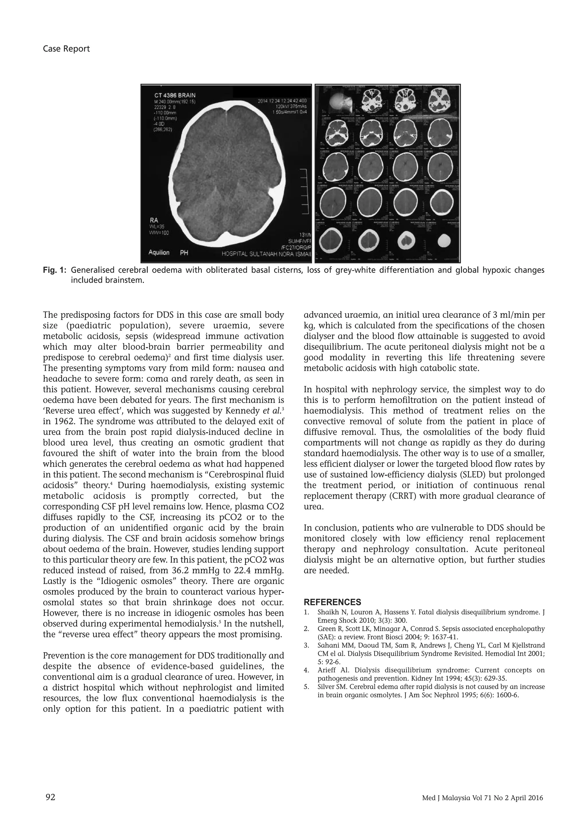 Dialysis disequilibrium-syndrome | PDF