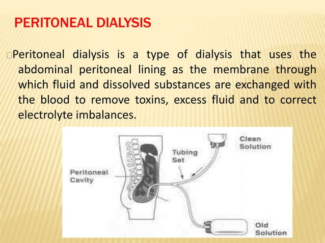 DIALYSIS2 Hemodialysis peritoneal d.pptx