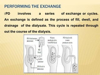 DIALYSIS2 Hemodialysis peritoneal d.pptx