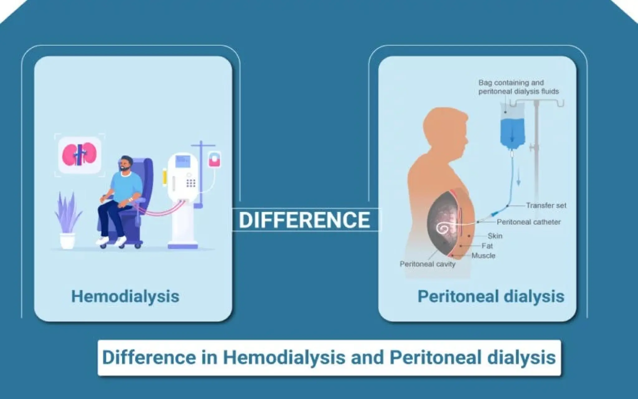 Dialysis power point presentation, including types of presentation | PPT