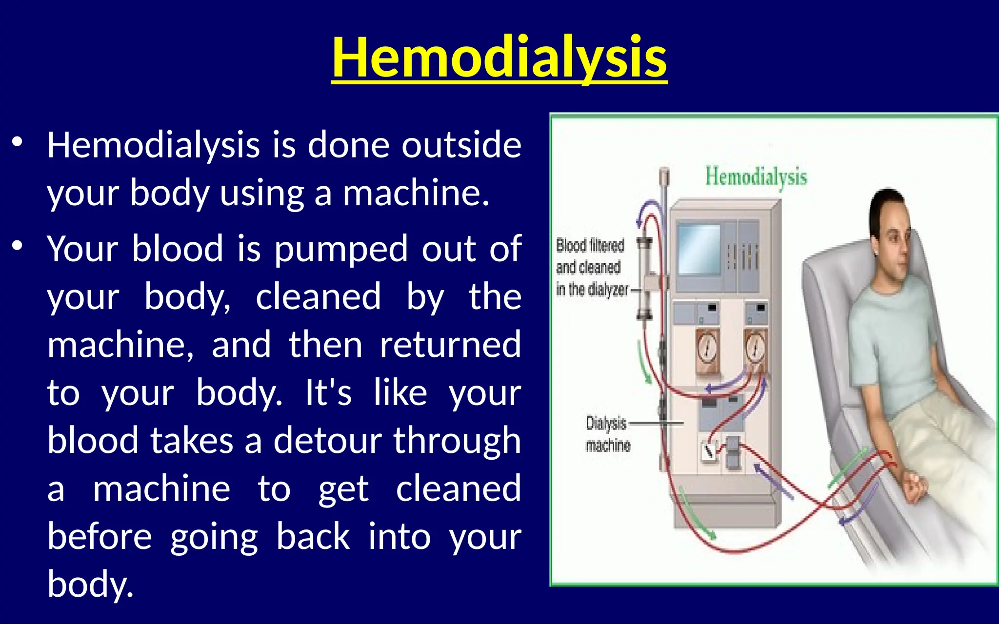 Dialysis power point presentation, including types of presentation | PPT