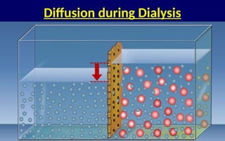 Dialysis power point presentation, including types of presentation | PPTX