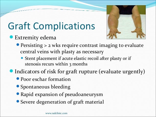 Dialysis access interventions