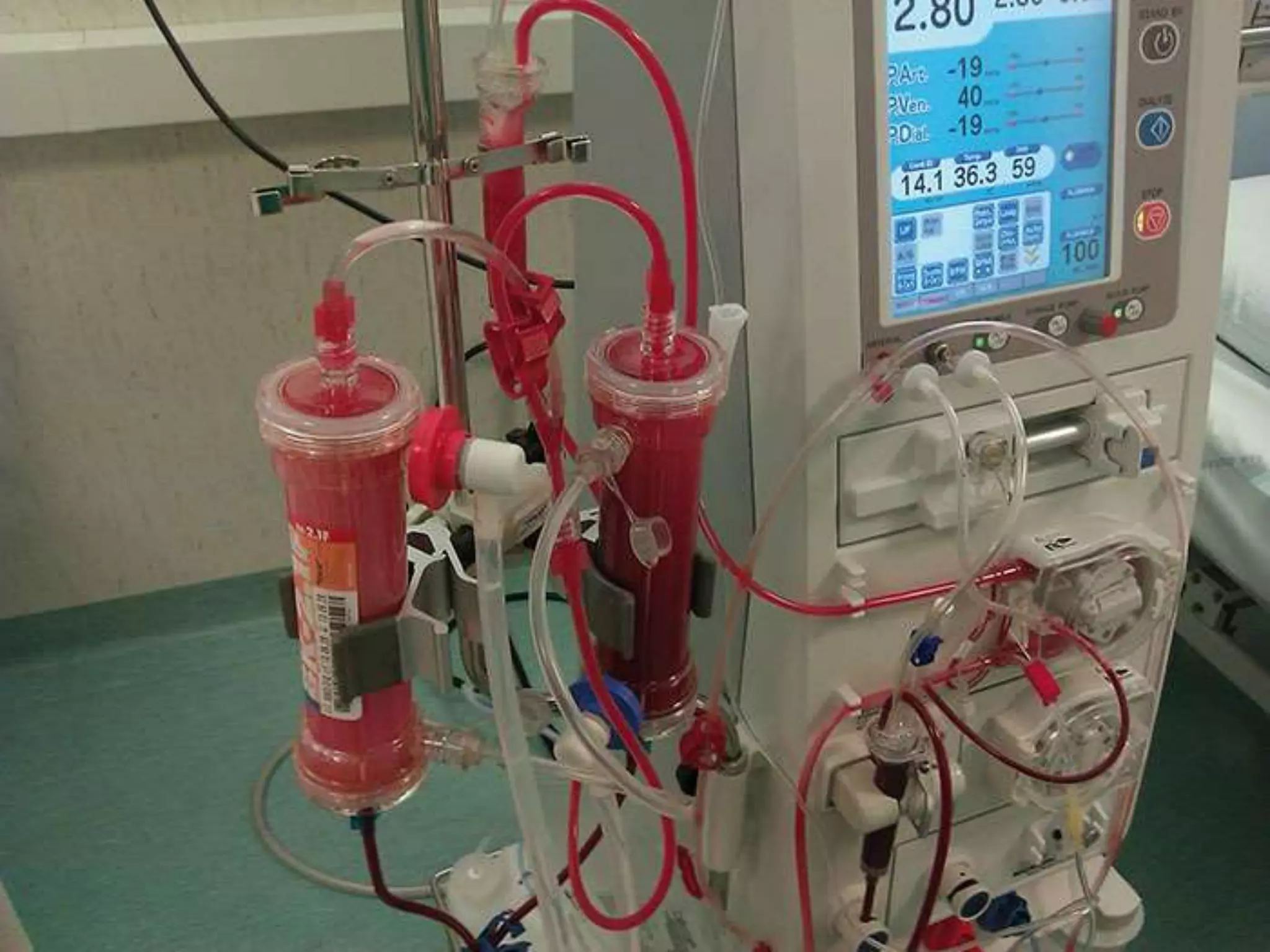 Dialysis complications dr A elbeally | PPTX