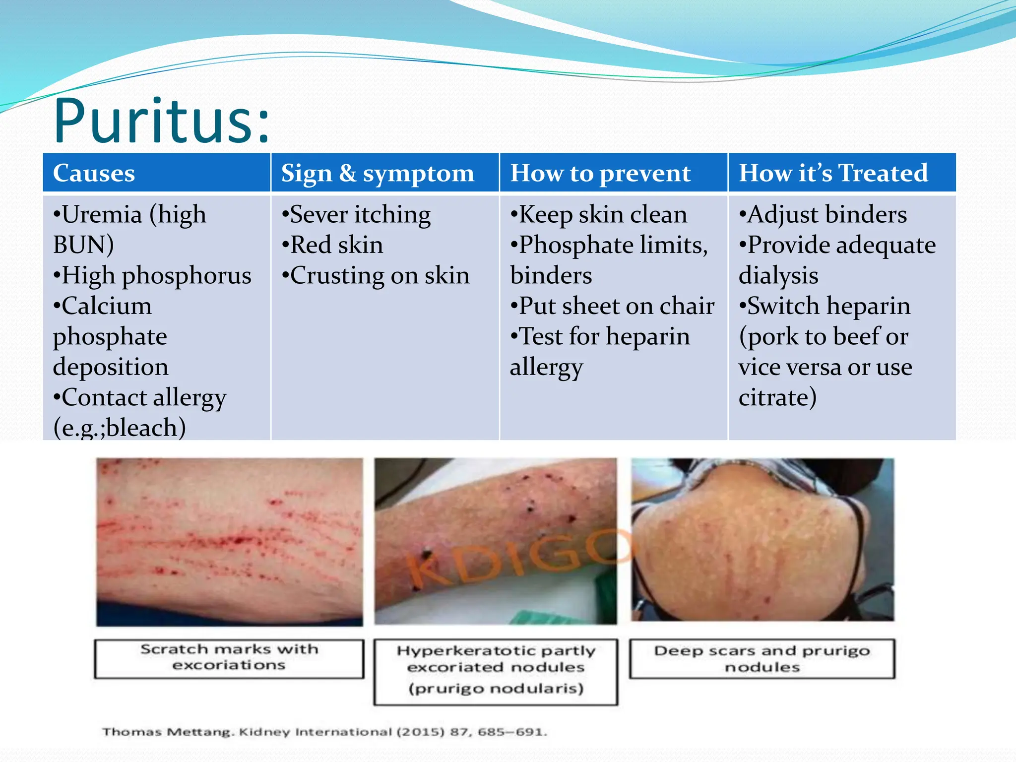 Dialysis & complications during dialysis.pptx