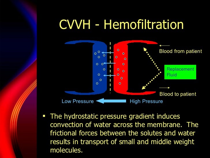 CRRT options in the ICU