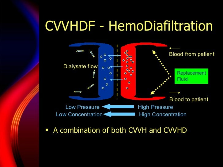 CRRT options in the ICU