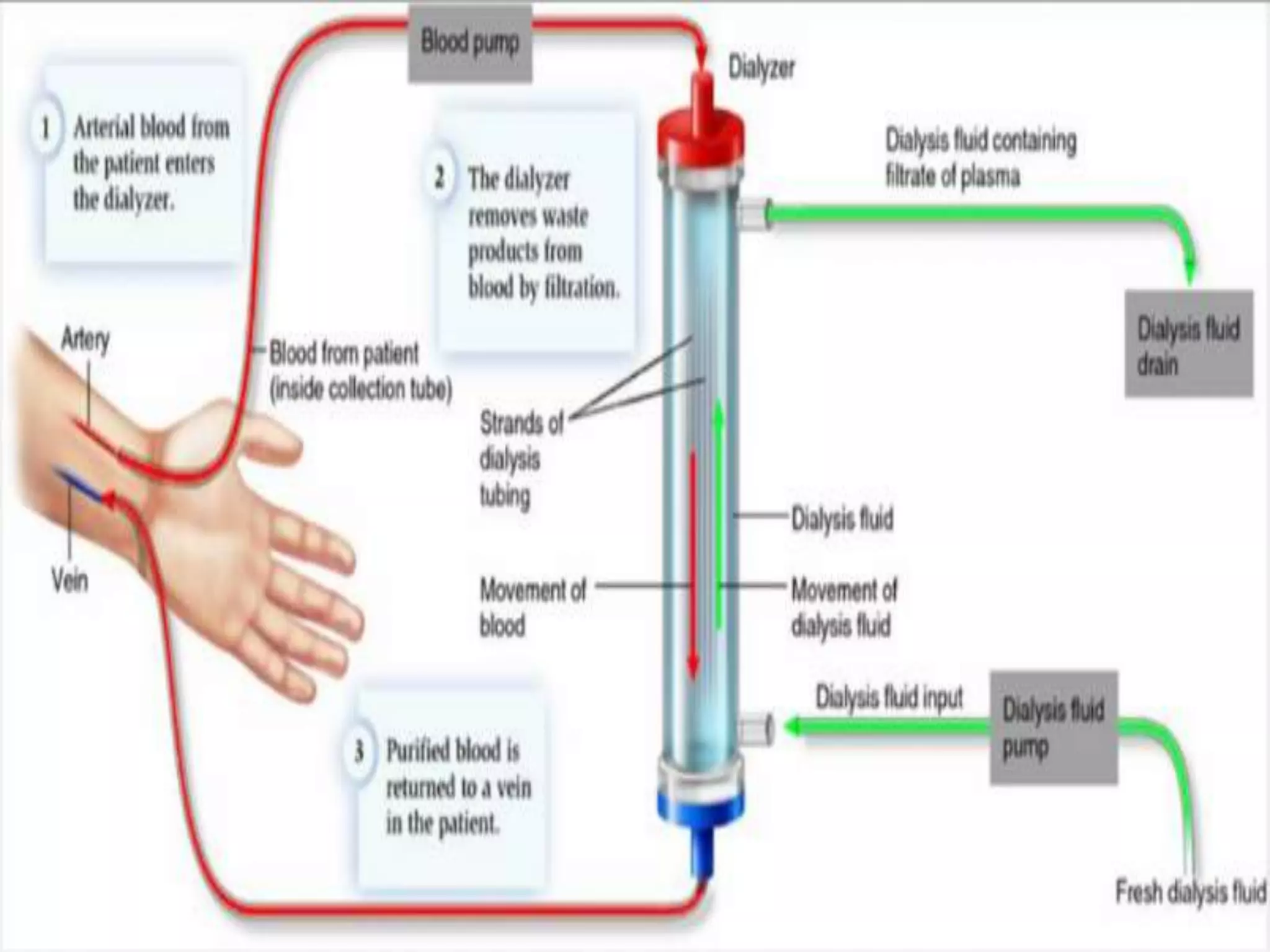 Dialysis prescription 2 | PPTX