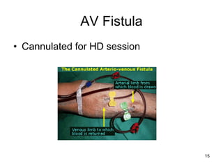 Dialysis Prescription In Renal Failure.pdf | Blood Disorders | Diseases ...