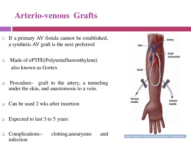 Dialysis various modalities and indices used