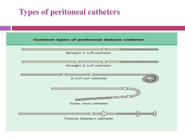 Peritoneal Dialysis Catheter Types Wholesale Universal Peritoneal