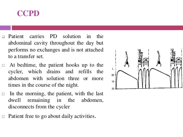 Dialysis various modalities and indices used