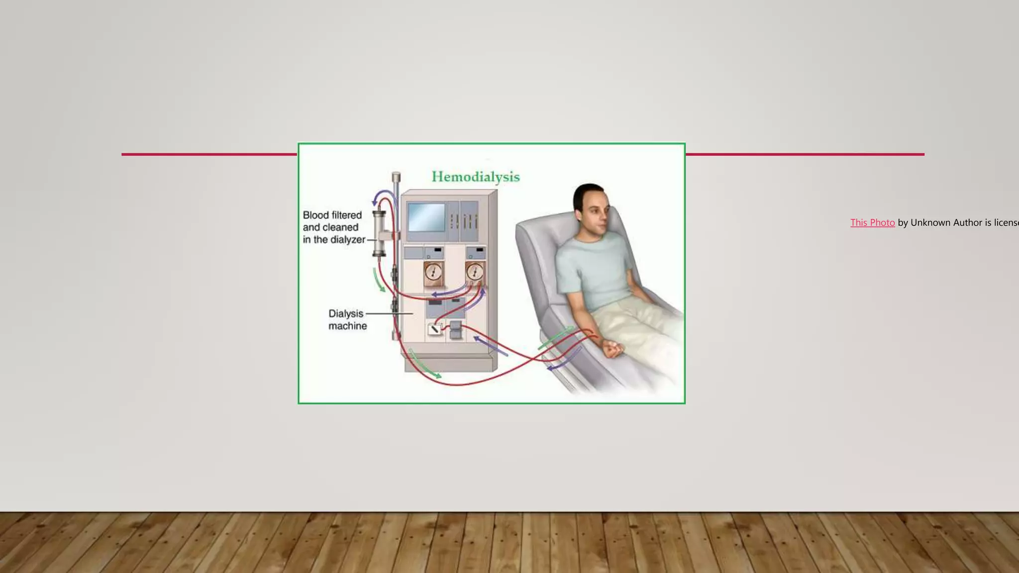Dialysis slideshare | PPTX