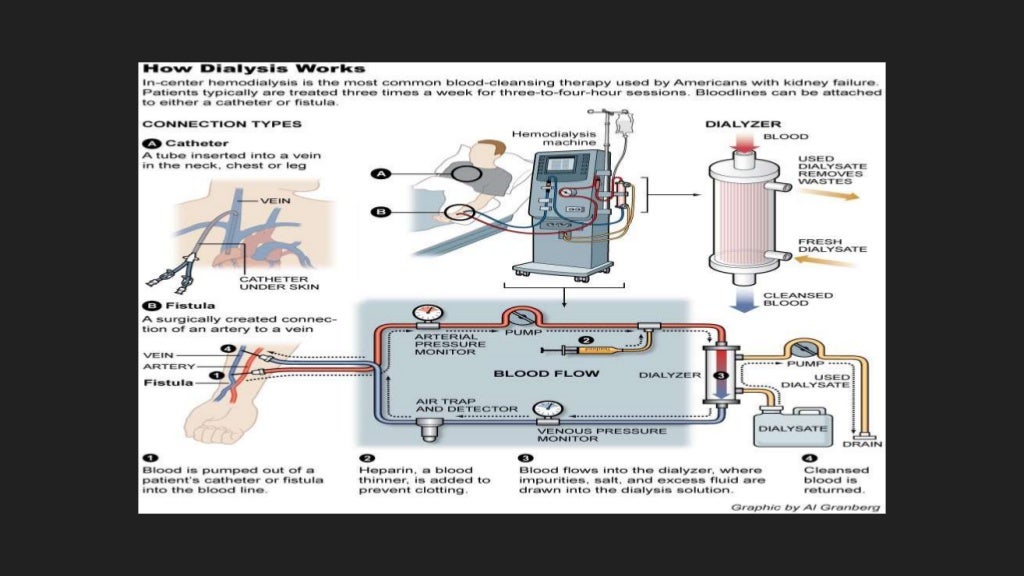 Dialysis types, procedure advantage and disadvantage