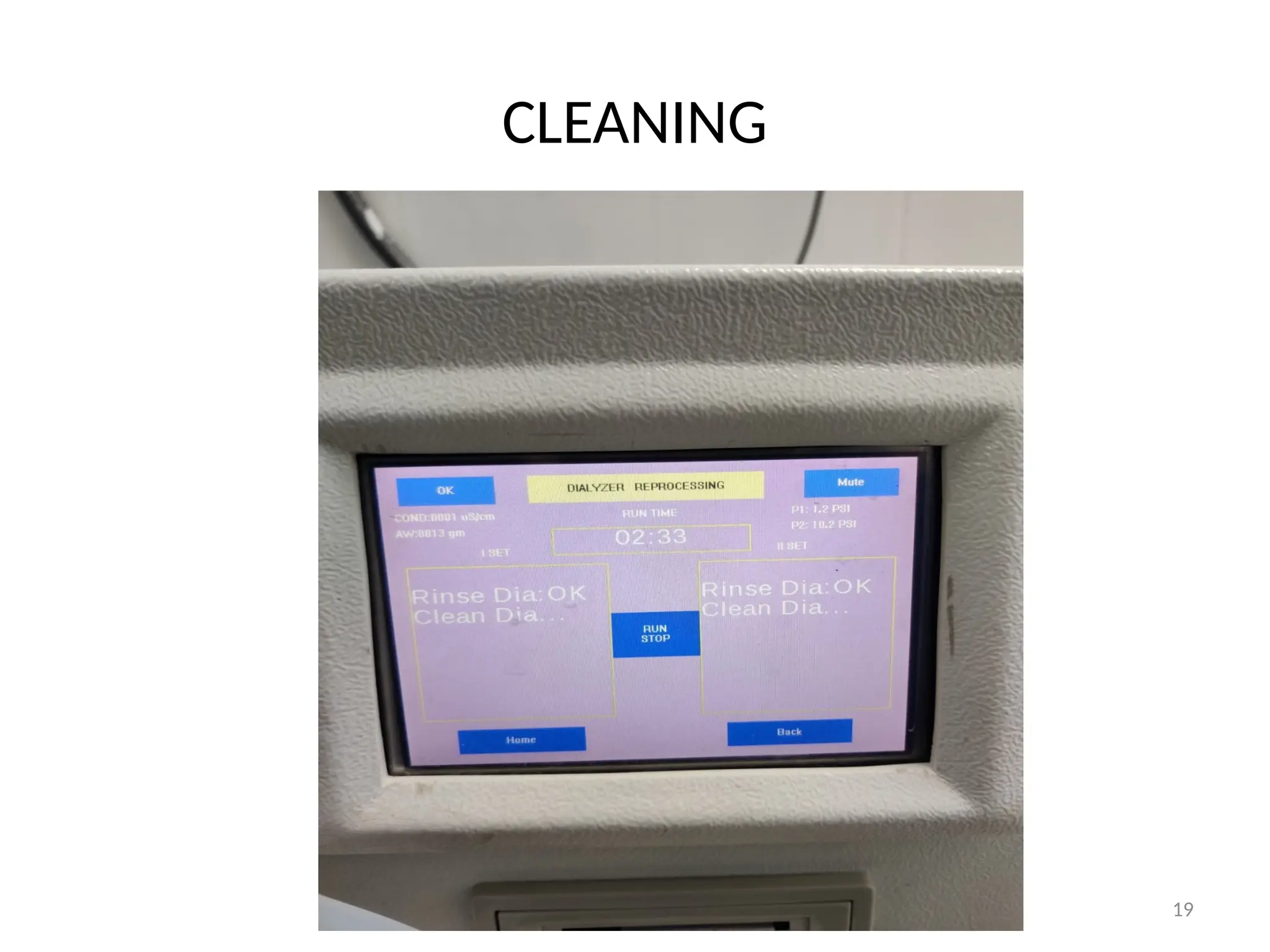 DIALYZER REUSE , Dialysis prescription.pptx