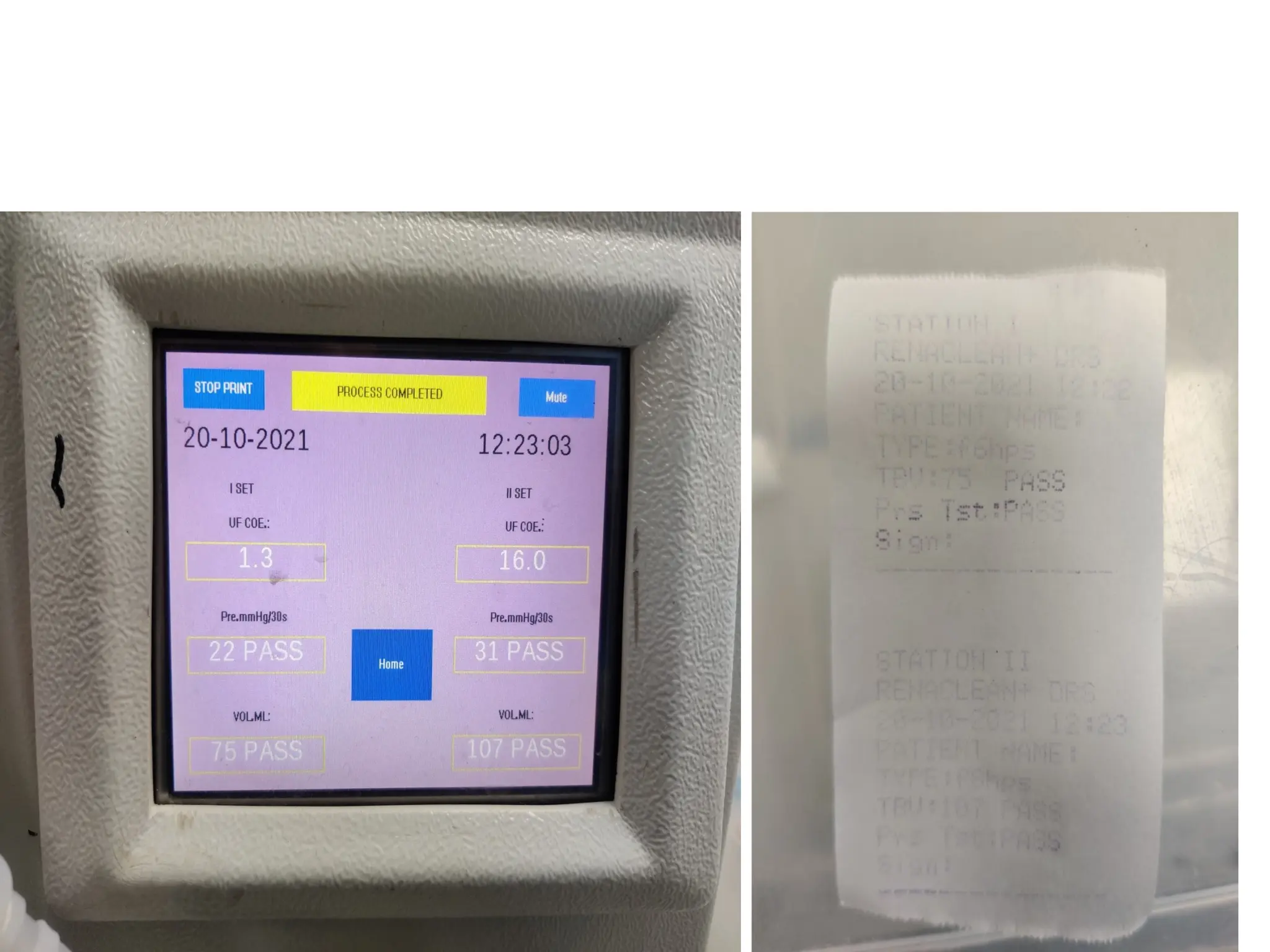 DIALYZER REUSE , Dialysis prescription.pptx