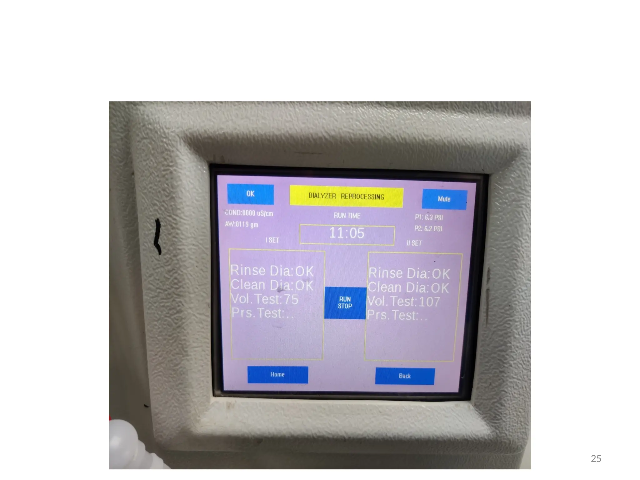 DIALYZER REUSE , Dialysis prescription.pptx