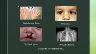 Diamond Blackfan anaemia .pptx