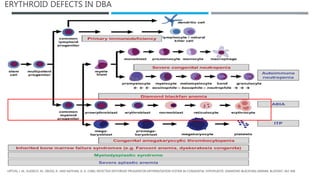 Diamond blackfan a nemia final | PPTX