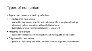 diamond concept union - luqman.pptx
