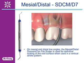 Diamond Tec File Scalers | PPT