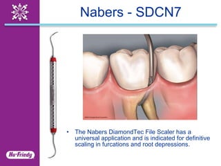 Diamond Tec File Scalers | PPT