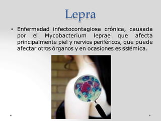 DIA MUNDIAL DE LA LUCHA CONTRA LA LEPRA.pptx