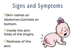 diaper rashes causes and treatment and prevention | PPTX