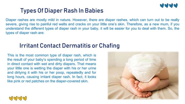 Diaper Rashes In Babies: Reasons, Symptoms and Treatments