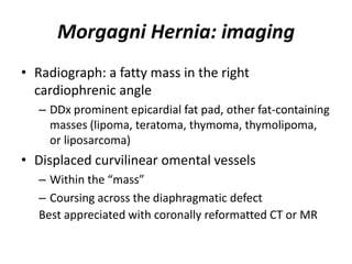 Diaphragmatic hernia and injury | PDF