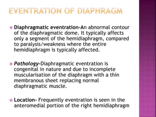 Diaphragmatic Disorders | PPTX
