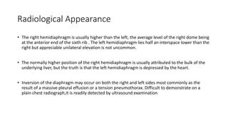 DISORDERS OF Diaphragm.pptx