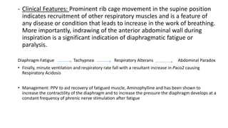 DISORDERS OF Diaphragm.pptx